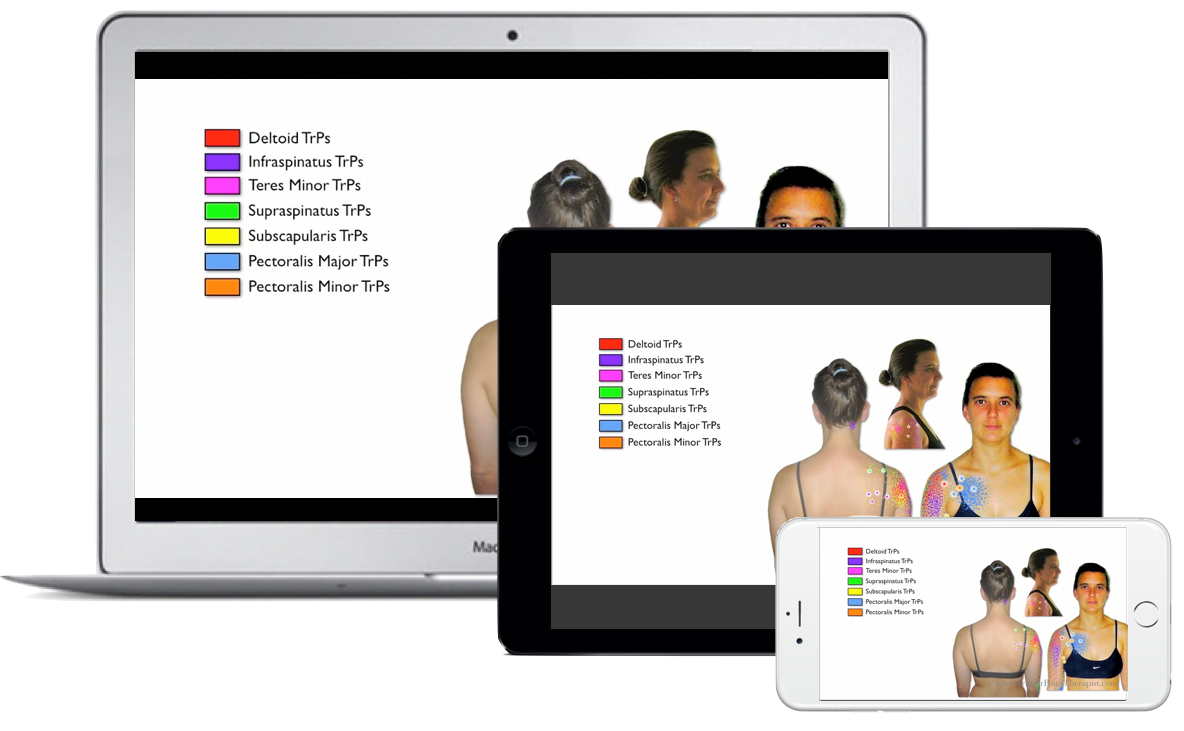 Trigger Point Therapy for Shoulder Pain Video | TriggerPointTherapist.com